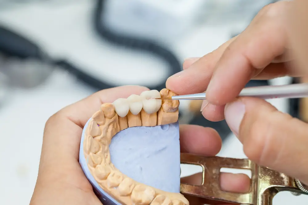 How Much Does A Dental Bridge Cost Without Insurance 