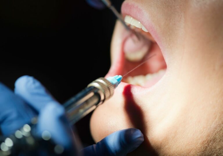 How Long Does It Take For Dental Numbing To Wear Off? (Ultimate Guide)