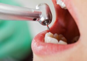 What Blood Pressure Is Too High For Dental Treatment? (With Tips)