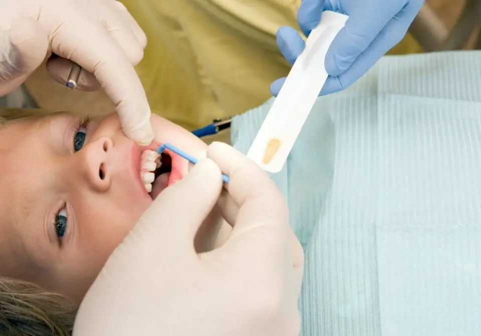 Why Do My Teeth Feel Numb And Tingly? (Causes & Treatment)