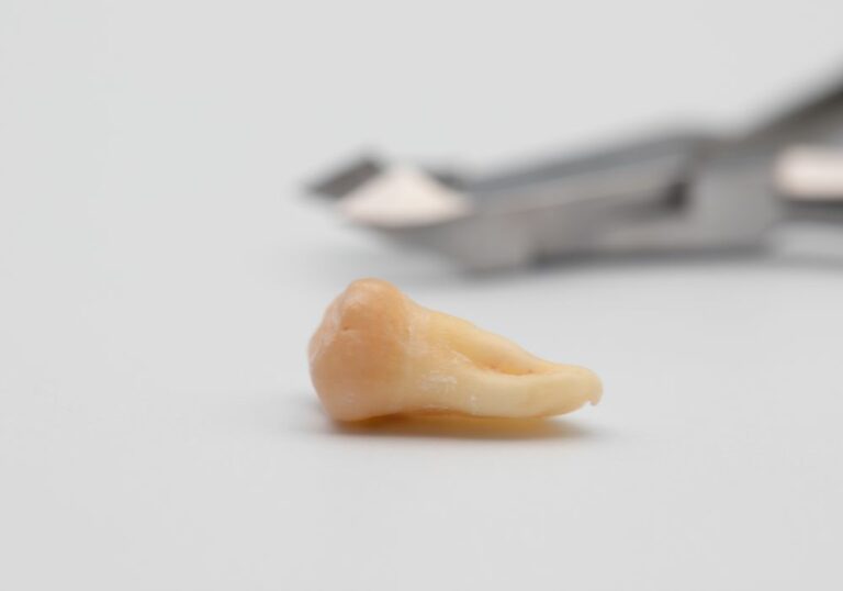 When Can I Eat Chicken After Wisdom Teeth Removal? (And What To Eat ...