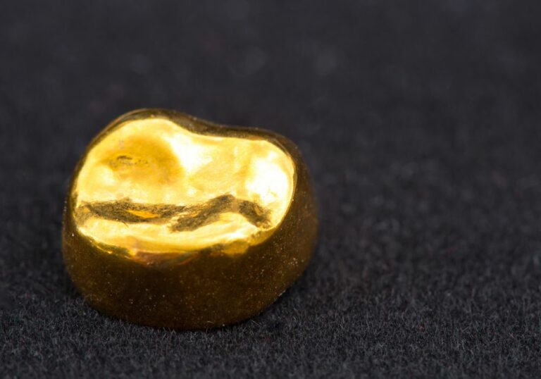 How Much Is Dental Gold Worth? (Evaluation Guide)