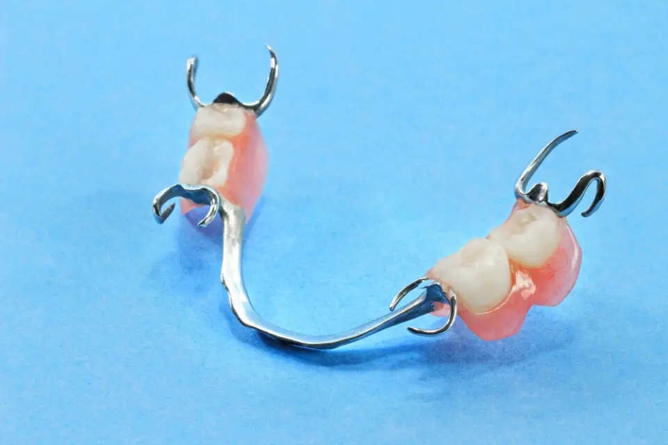 Why Do My Teeth Feel Fuzzy? (Causes & Treatment)