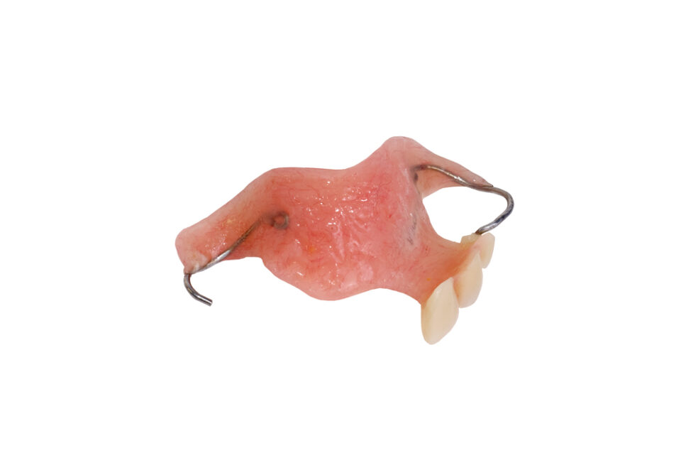 Can I reshape my canine teeth? (4 options for you)