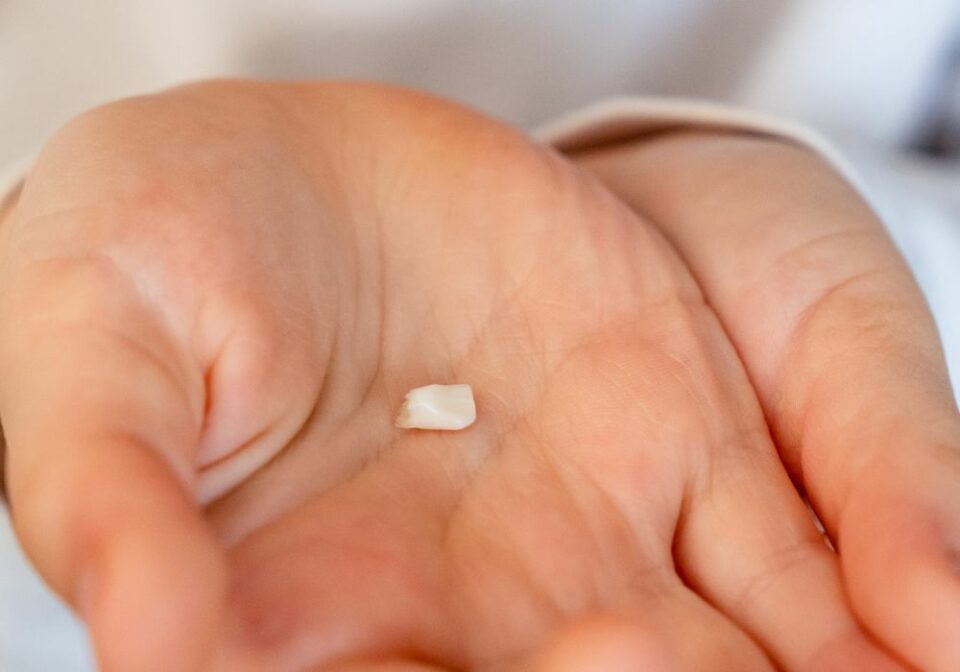 What Happens When a Tooth is Drilled? A Friendly Explanation