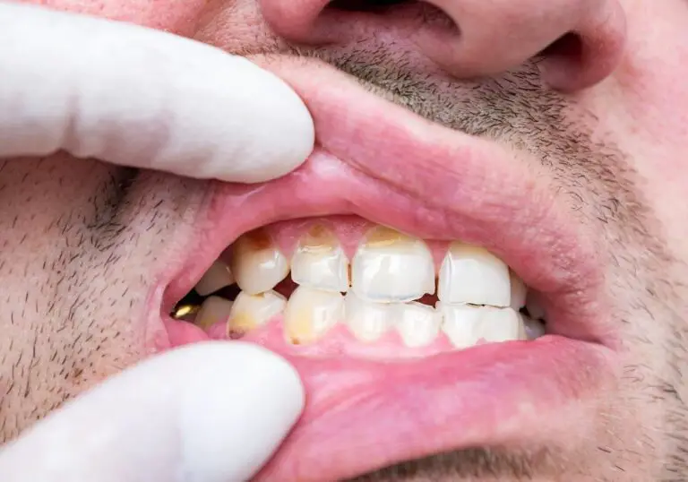 Why Does Coffee Make My Teeth Yellow? (How To Treat & Prevent Stains)
