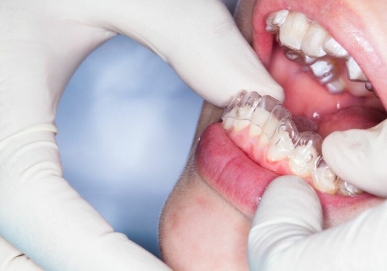 Can a tooth change position? What are the causes and treatments?