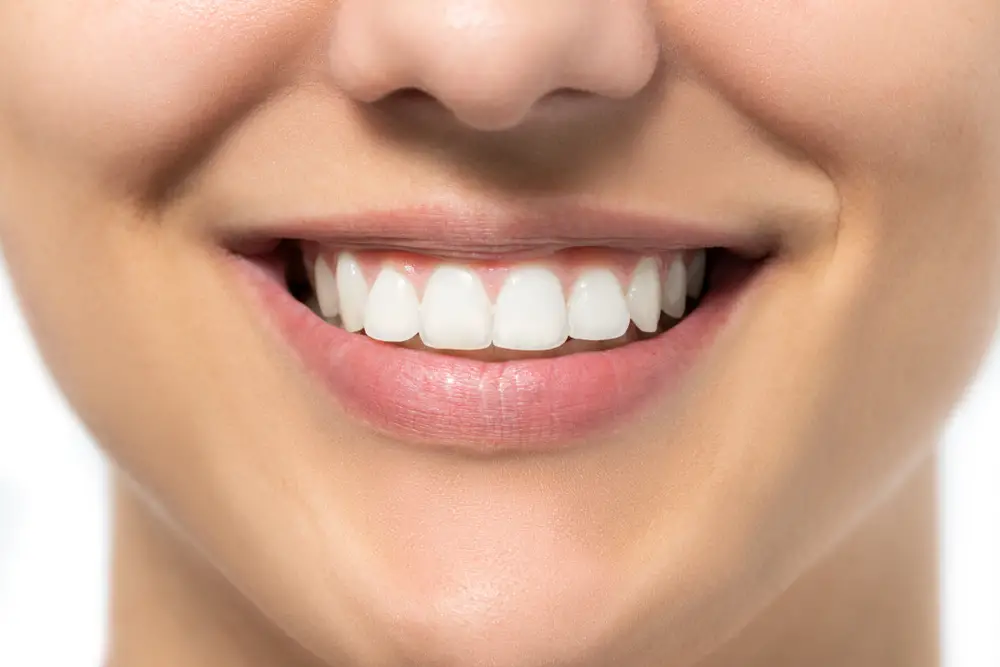 Permanent Vampire Teeth Caps