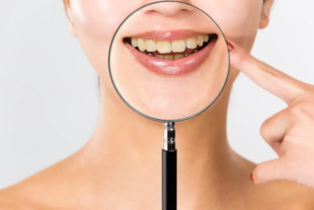 Can You Tell Your Ancestry by Your Teeth? (Exploring the Link Between ...