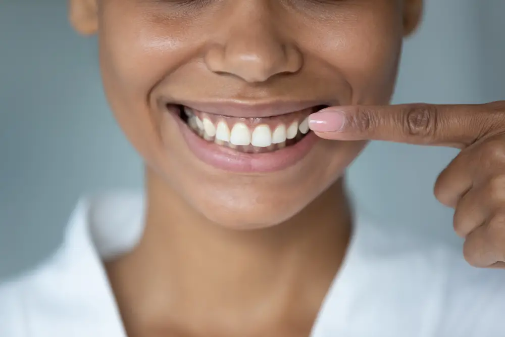 Can Cats' Teeth Get Too Long? Treating Overgrown Teeth