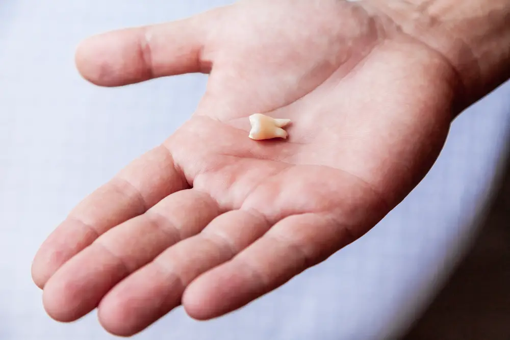 Can Teeth Fall Out Naturally? What are the causes?