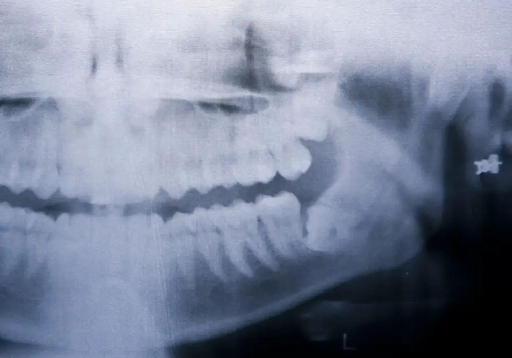 Can Cats' Teeth Get Too Long? Treating Overgrown Teeth