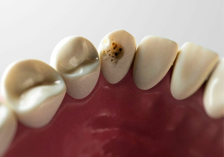 How to Remove Stains from Your Teeth at Home: Easy Tips and Tricks