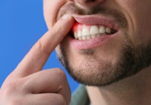 Why Is My Tooth Bleeding So Bad? (Causes & Professional Treatment)