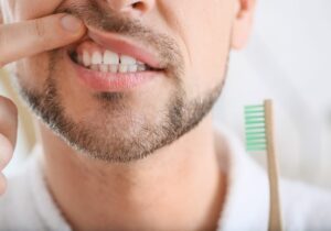 Why Are My Teeth Getting So Thin? (Tooth Enamel Loss)