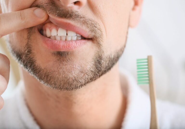 Why Are My Teeth Getting So Thin? (Tooth Enamel Loss)