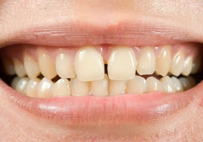 Are Canine Teeth Called Incisors? (The Ultimate Comparison)
