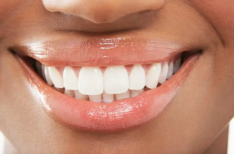 Why Are Some People's Teeth Naturally Whiter? Discover the Science ...