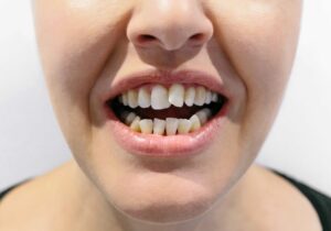 Why Did Humans Evolve Crooked Teeth? (Teeth Evolution Explained)