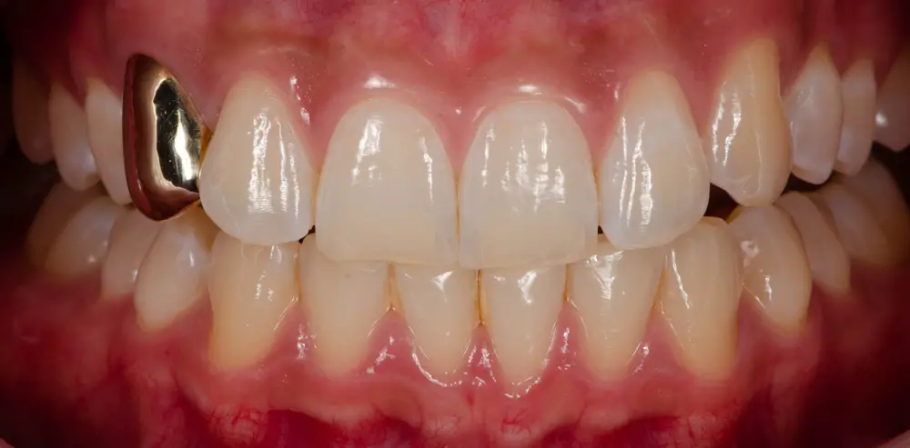 Why Is Toothache Worse At Night? (Causes & Relieving Tips)