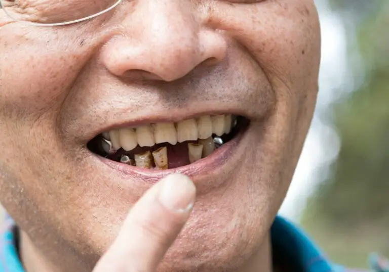 How Many Teeth Can You Live Without? (Detailed Explanation)