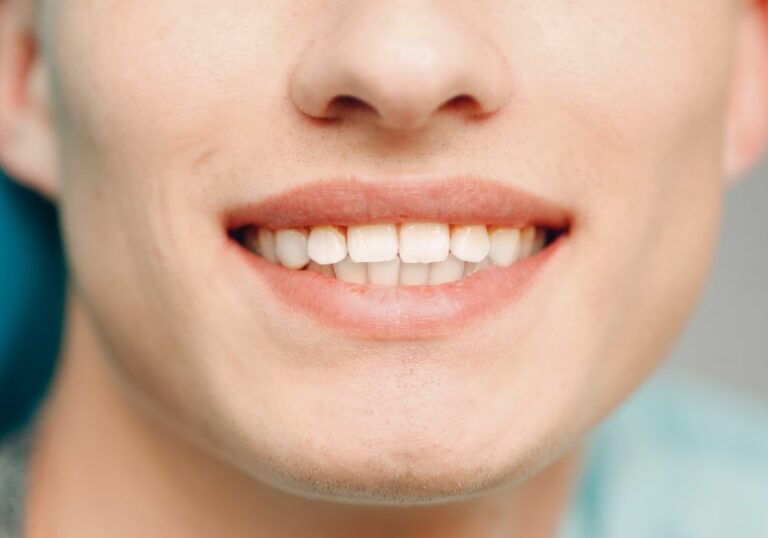 Why Are Straight Teeth More Attractive? (17 Reasons Explained)