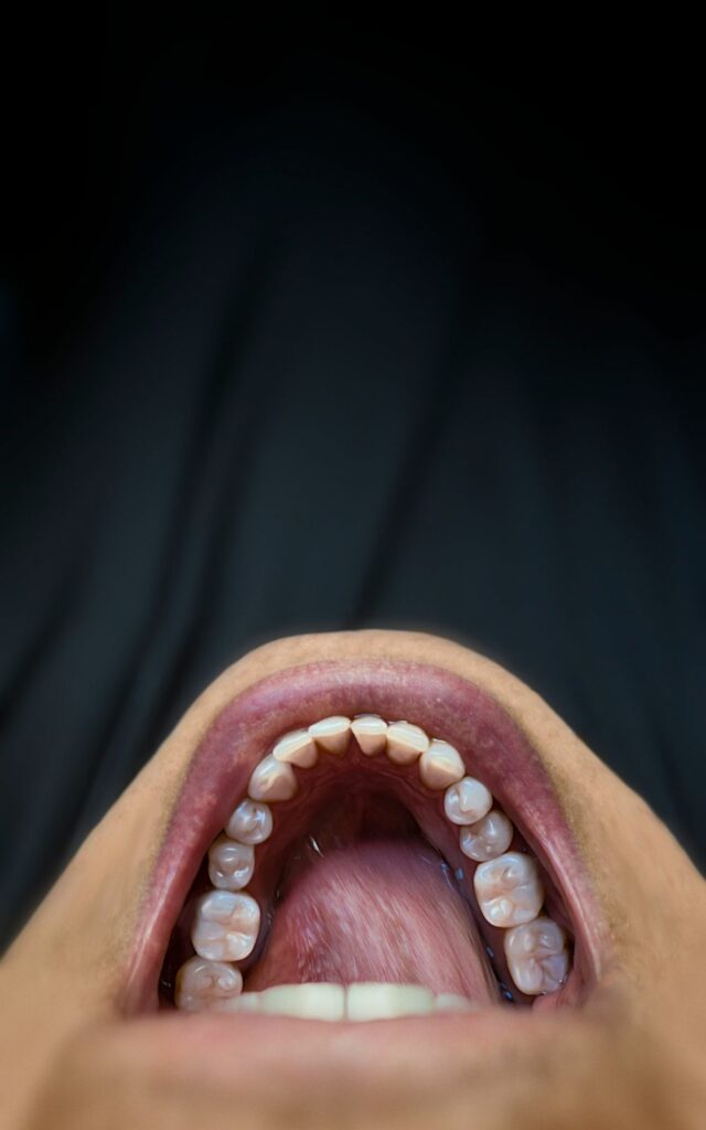 Why Do I Only Have 15 Bottom Teeth? Exploring the Reasons Behind This ...