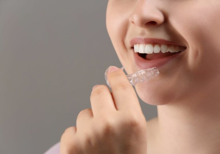 Can tooth mobility be fixed? (short-term & long-term remedies)