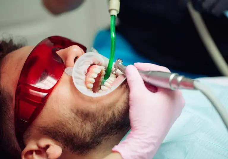 Can I Get My Teeth Cleaned On NHS? (Ultimate Guide)