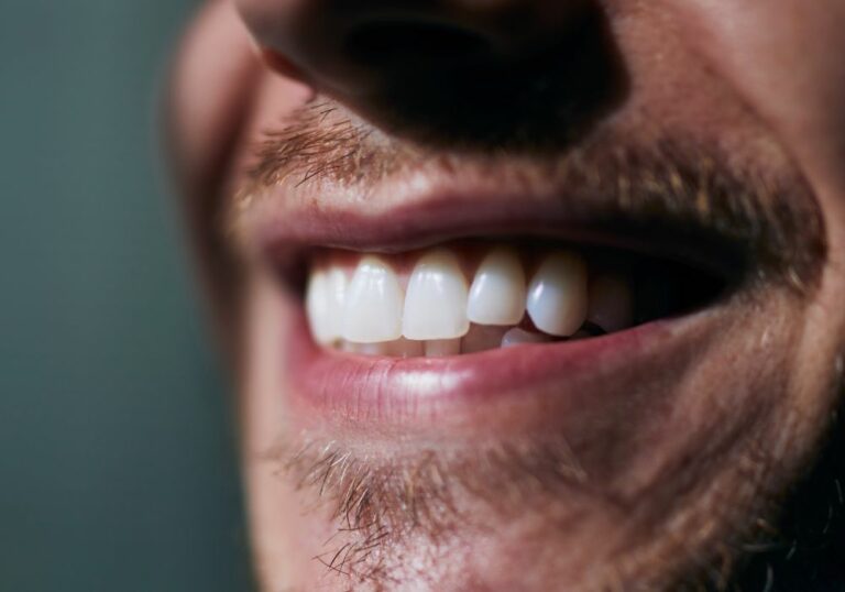 Why Are Some People's Teeth So Pointy? (Dental Treatments)
