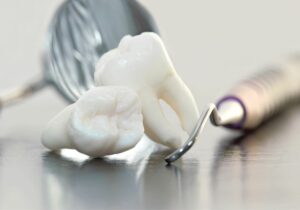 Why Are My Teeth Roots So Big? (Causes, Diagnosis & Treatments)
