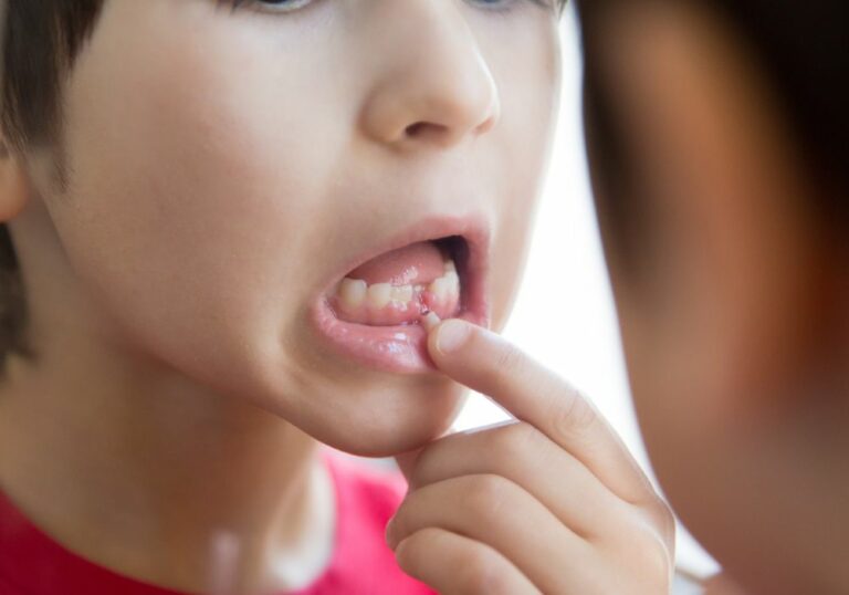 Can A Loose Tooth Tighten Back Up? (Causes & Treatments)