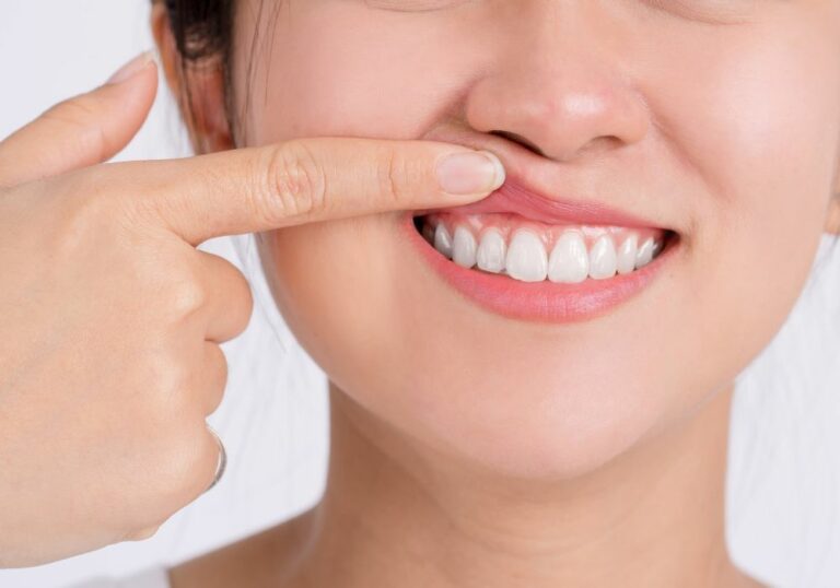 Can gums pull away from teeth? (symptoms, stages and treatments)