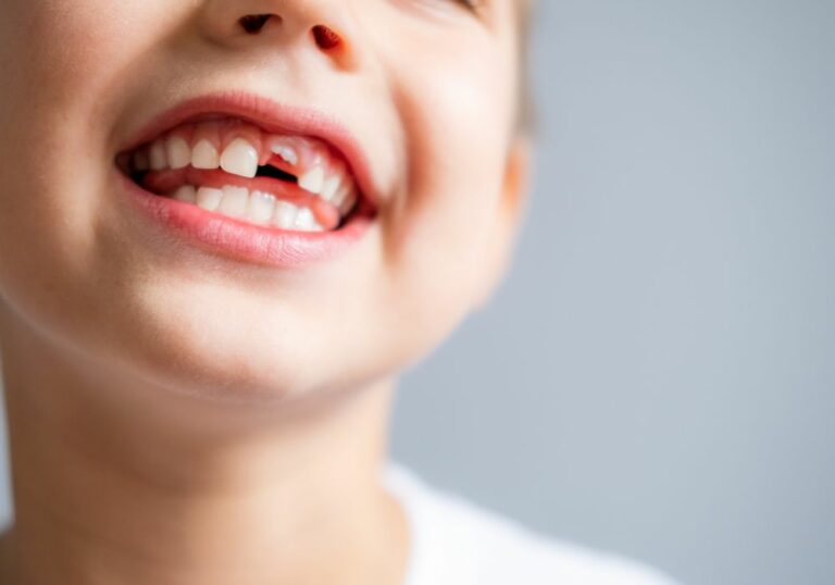 Why Do My Top Teeth Not Show When I Talk? (Causes & Treatments)