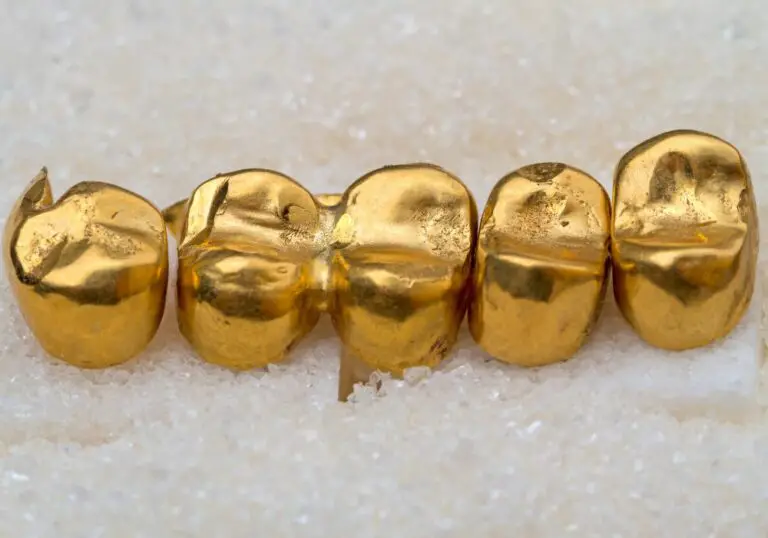 Why Does Johnny Depp Have Gold Teeth? (An In-Depth Look)