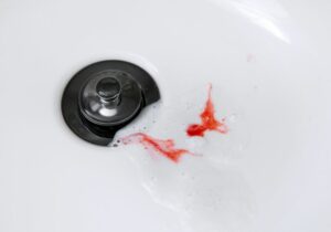 Why Do Teeth Bleed So Much? (Causes, Risks & Treatment)