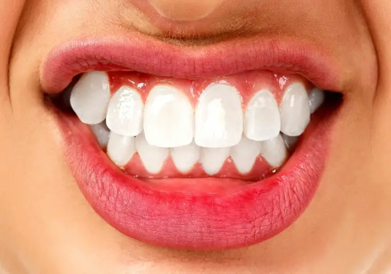 What Can I Do If My Teeth Are Too Big? Tips and Solutions