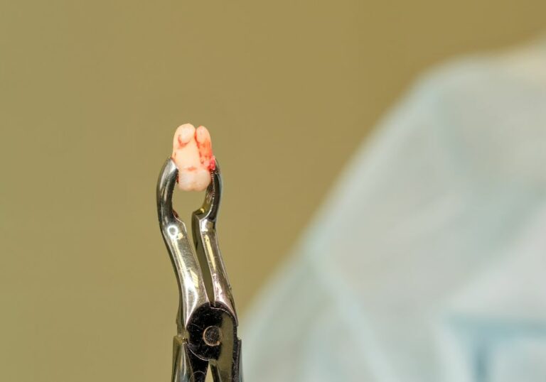 Can You Feel a Blood Clot Dislodge in Wisdom Tooth? Explained