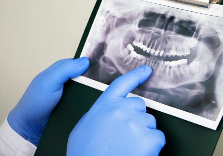 Naturally Regenerating Bone Loss in Teeth: Tips and Tricks