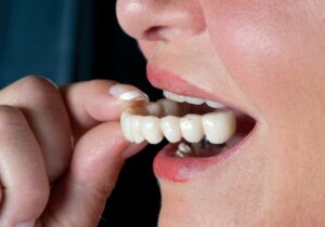 Temporary Teeth: A Solution While Waiting for Dentures?