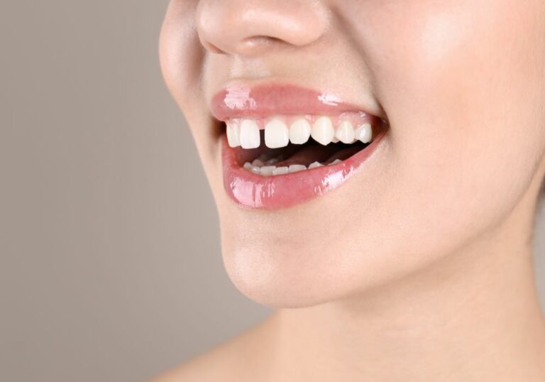 Why do I have a big gap between my 2 front teeth? (Explained)