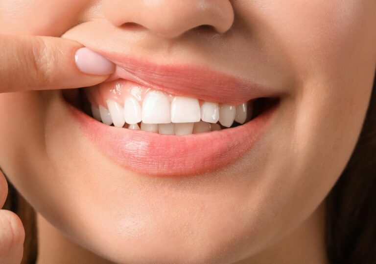 How Can I Increase Gum In My Mouth? (9 Natural Ways)