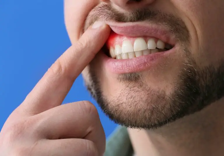 Why does my gum hurt in one spot when I brush it? (Causes & Solutions)