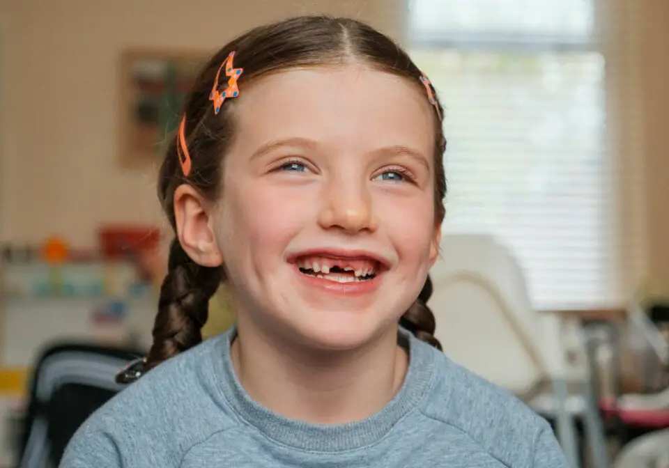 How Long Do Teeth Last After Falling Out? (Everything You Need To Know)