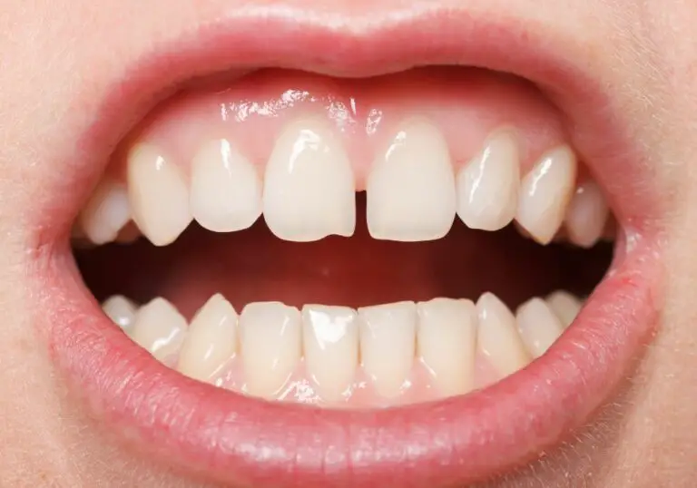 Are Canine Teeth Called Incisors? (The Ultimate Comparison)