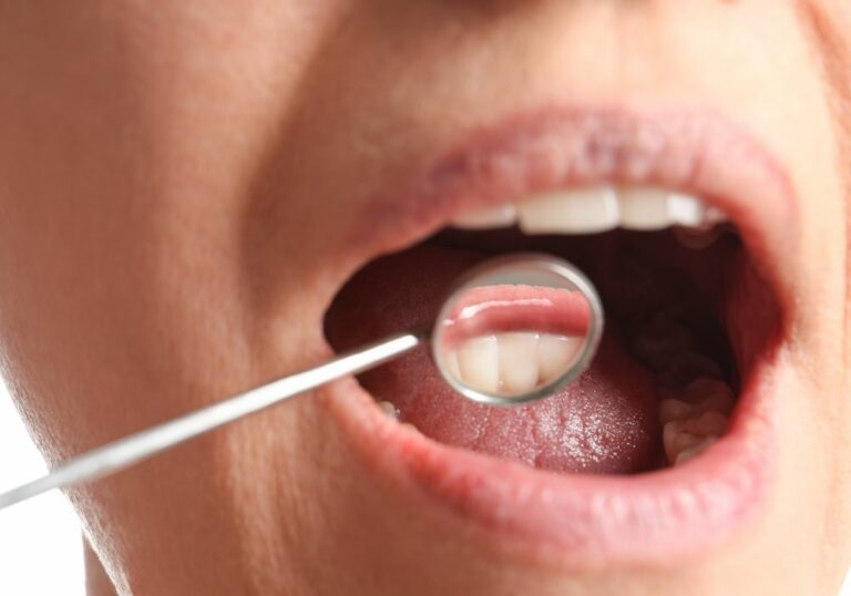 Why Is My Gum Tearing Off? (Cause, Symptoms & Treatment Options)