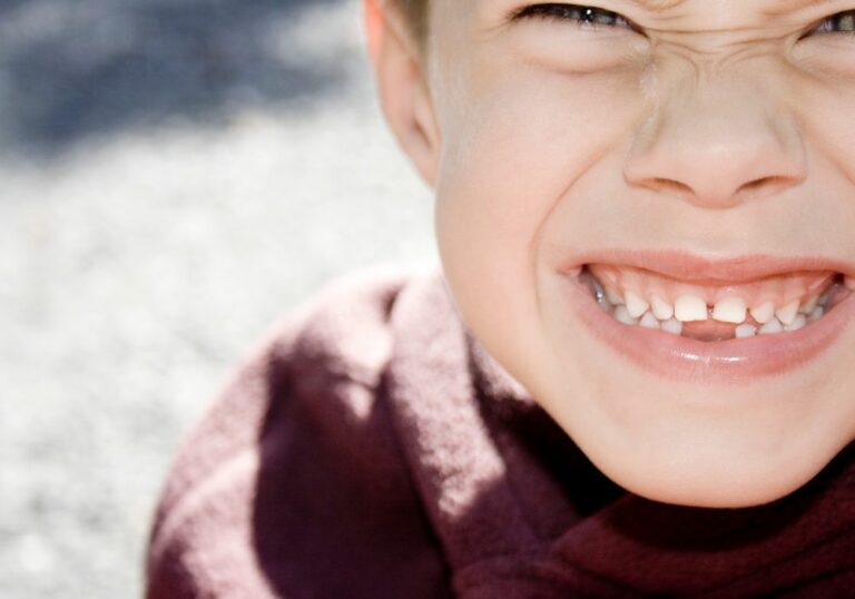 Why do I aggressively grind my teeth at night? (Causes & Solutions)