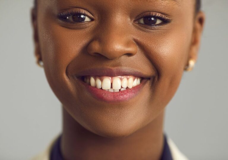 How Can I Close My Teeth Gap Without Braces? (At-Home Options)