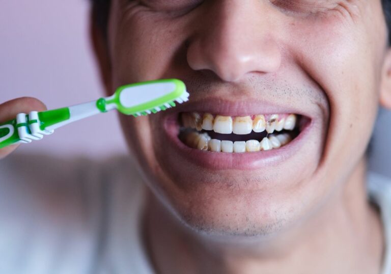 Why Is White Stuff Forming On My Teeth? (How To Remove Plaque)