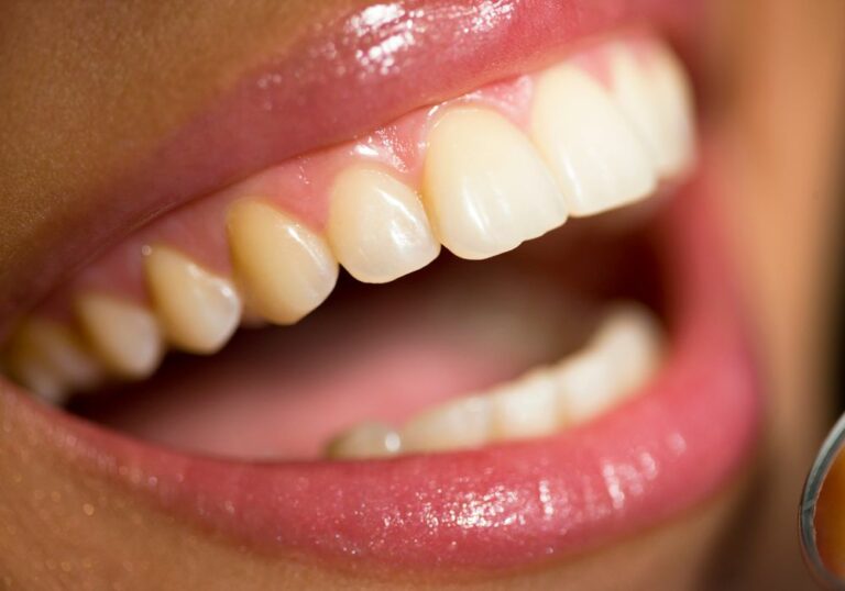 Why Do My Top Teeth Not Show When I Talk? (Causes & Treatments)